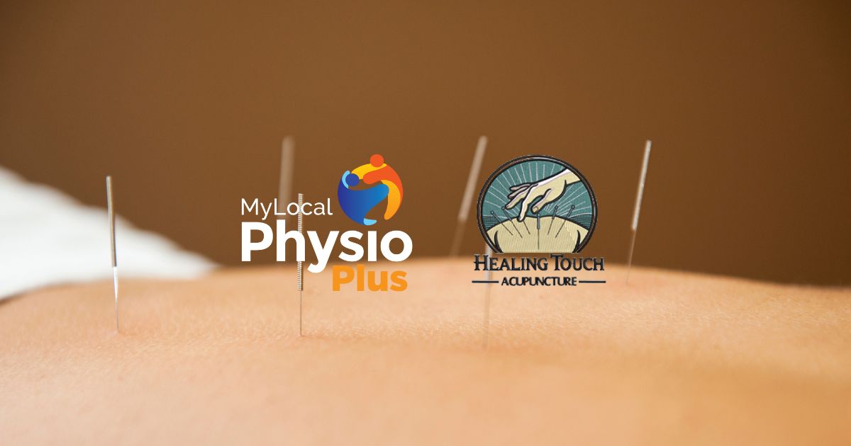Acupuncture at My Local Physio Plus | Pain Relief & Holistic Health | My Local Physio Plus